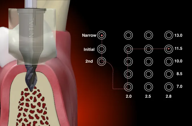 Personalized drilling sequence for the patient