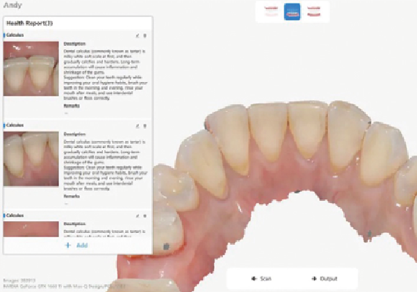 R2i3 intraoral scanner
