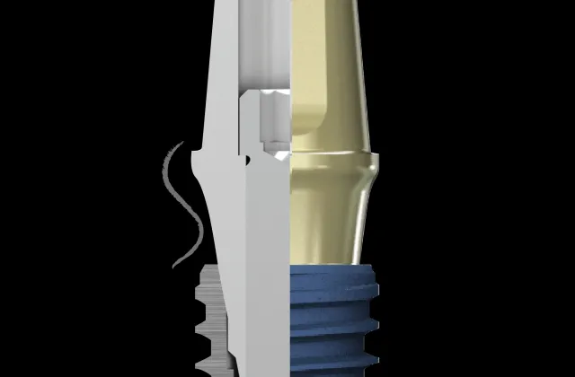 anyone implant giving excellent soft tissue response