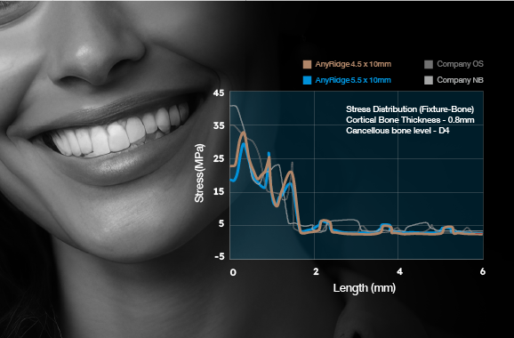 anyridge implant and effects on aesthetics