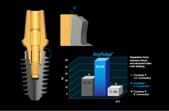 anyridge implant no screw loosening because of morse taper