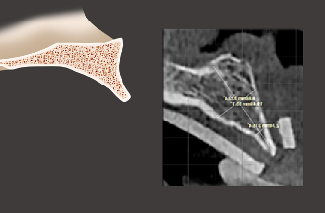 Checking total length