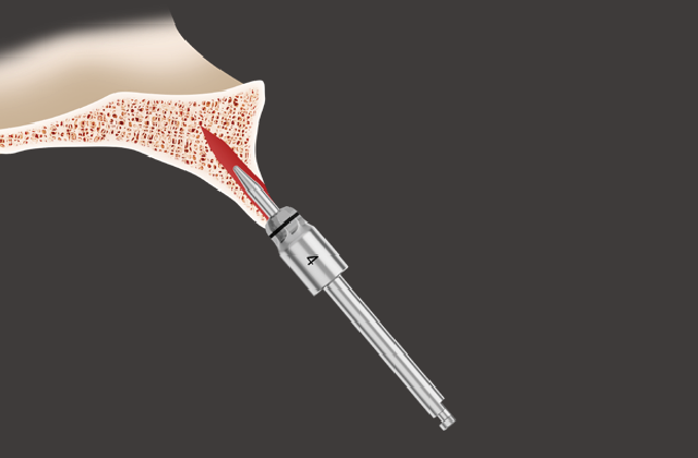 measuring height with caliper