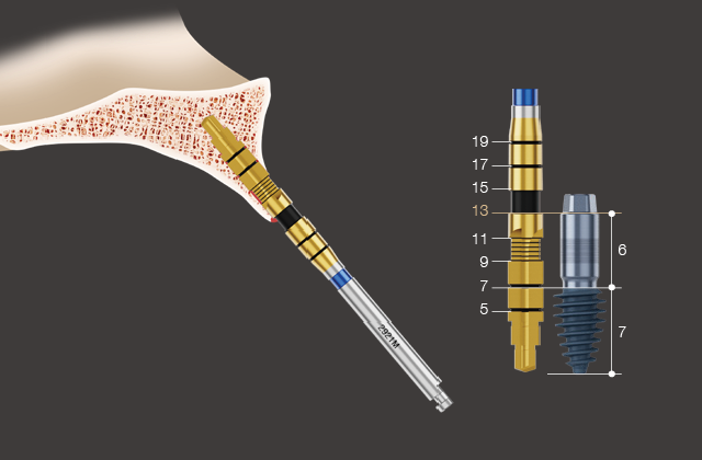 measuring height with caliper
