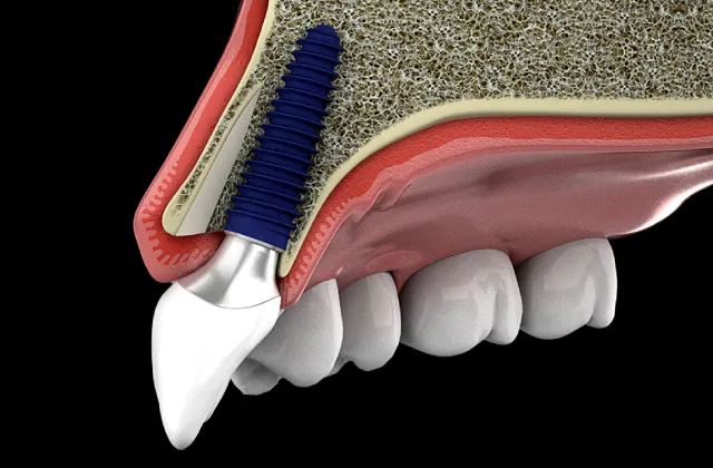 smooth vibration causes no excessive harm to teeth during procedure