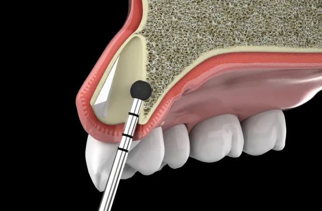 precise even with high speed rotation